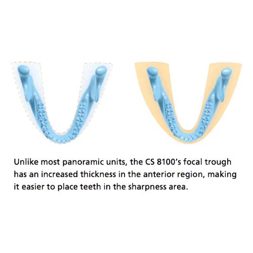 Carestream CS8100 2D+ Digital OPG