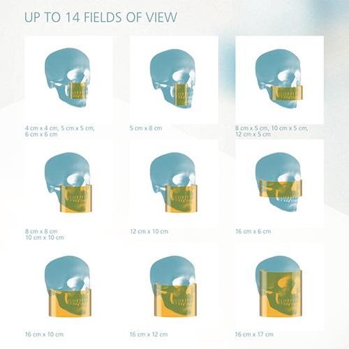 Carestream CS9600 CBCT OPG